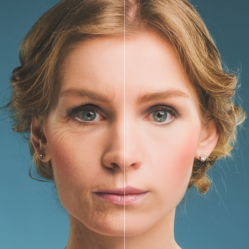Benefits of Receiving the Botox Procedure